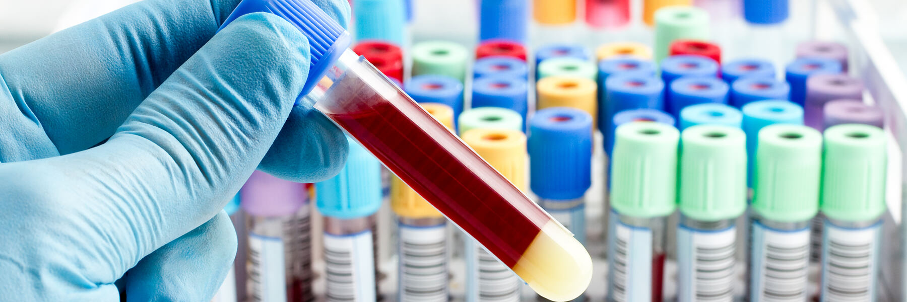 sample-collection-page – LifeLabs Genetics